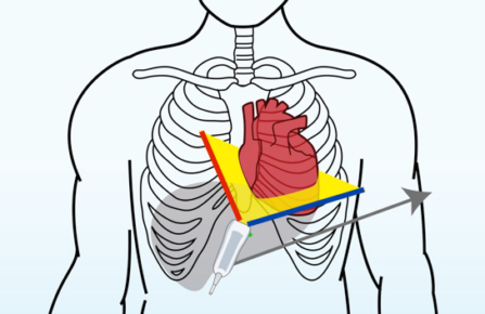 How to Become a Cardiac Sonographer? Learn Cardiac Ultrasound