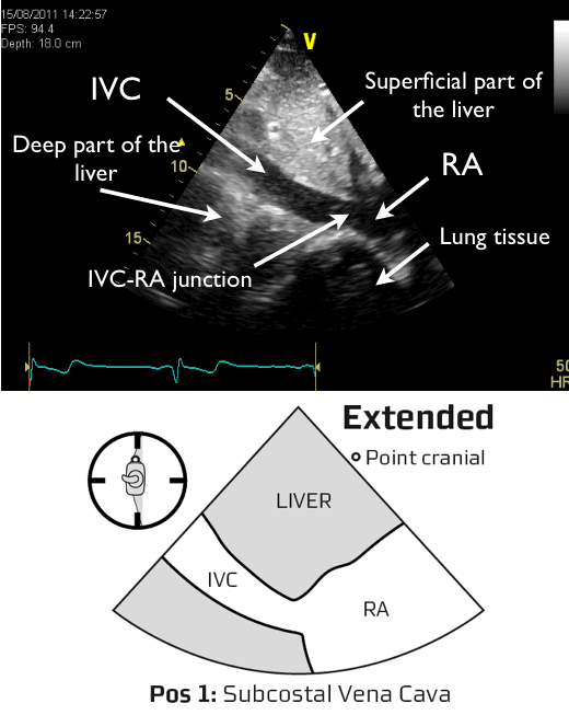Cardiac ultrasound Archives - Page 13 of 41 - USabcd