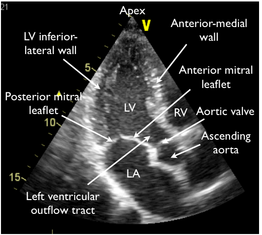 Cardiac ultrasound Archives - Page 11 of 41 - USabcd