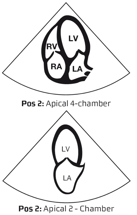 Cardiac ultrasound Archives - Page 10 of 41 - USabcd