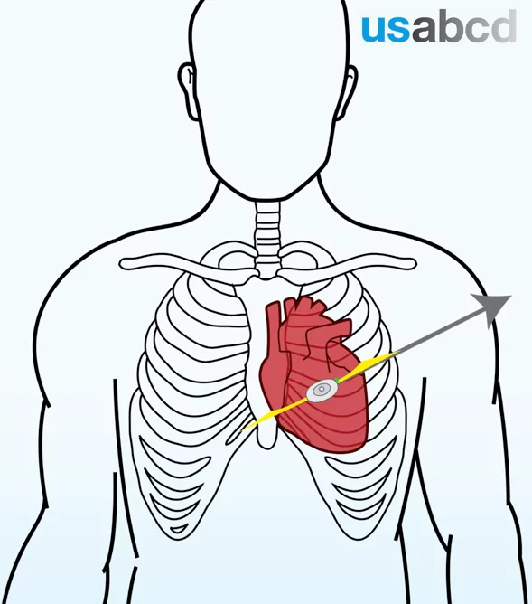 Cardiac ultrasound Archives - Page 16 of 41 - USabcd
