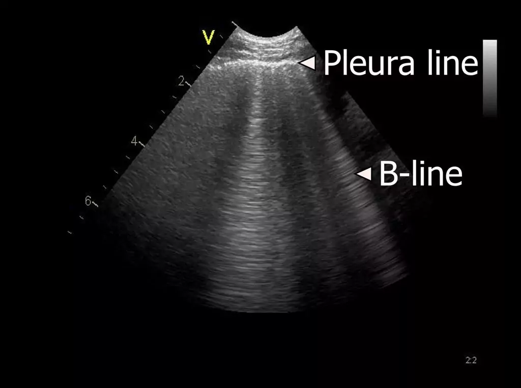 English Archives - Page 3 of 17 - USabcd